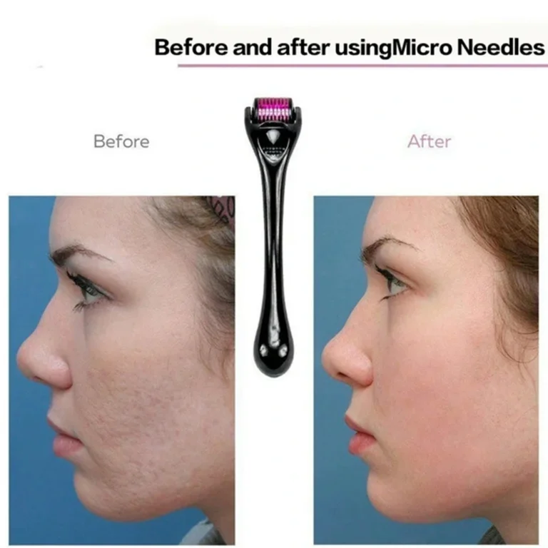 Derma Roller – Homovia